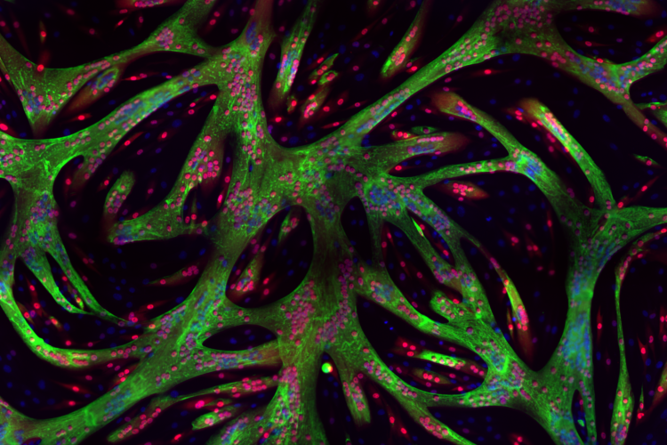 Fusion and Regeneration of Skeletal Muscles | The Membrane Remodeling Lab